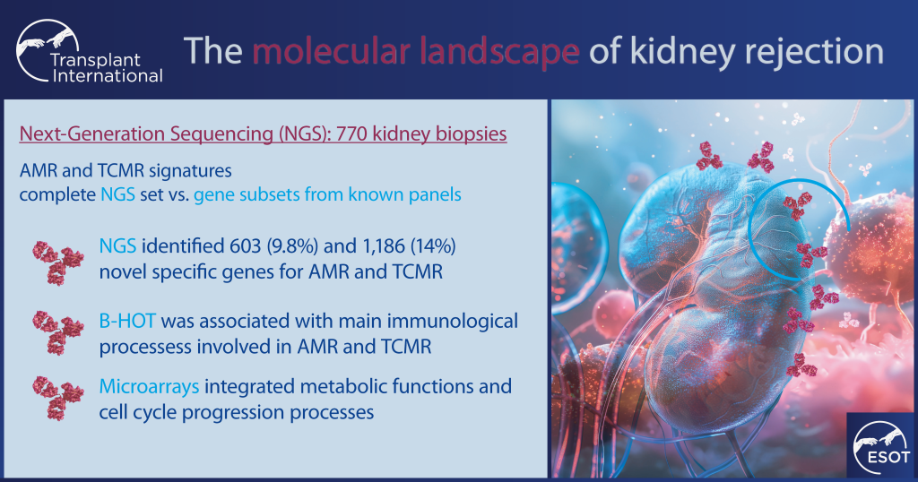The molecular landscape of kidney rejection • ESOT